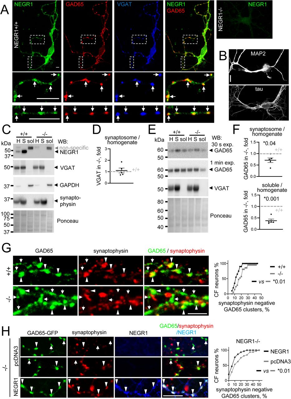 Mouse Anti Gad6 Gad2 | Developmental Studies Hybridoma Bank | Bioz