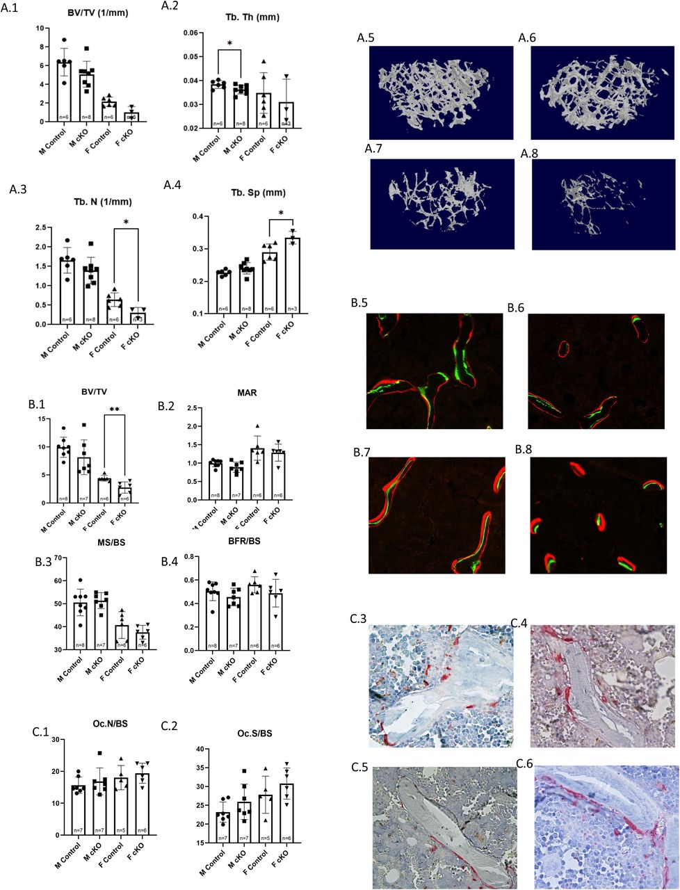 Osteomeasure Histomorphometry Software | OsteoMetrics inc | Bioz