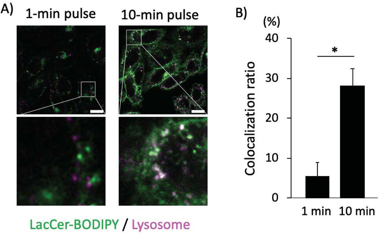 Laccer Bodipy | Nikon | Bioz