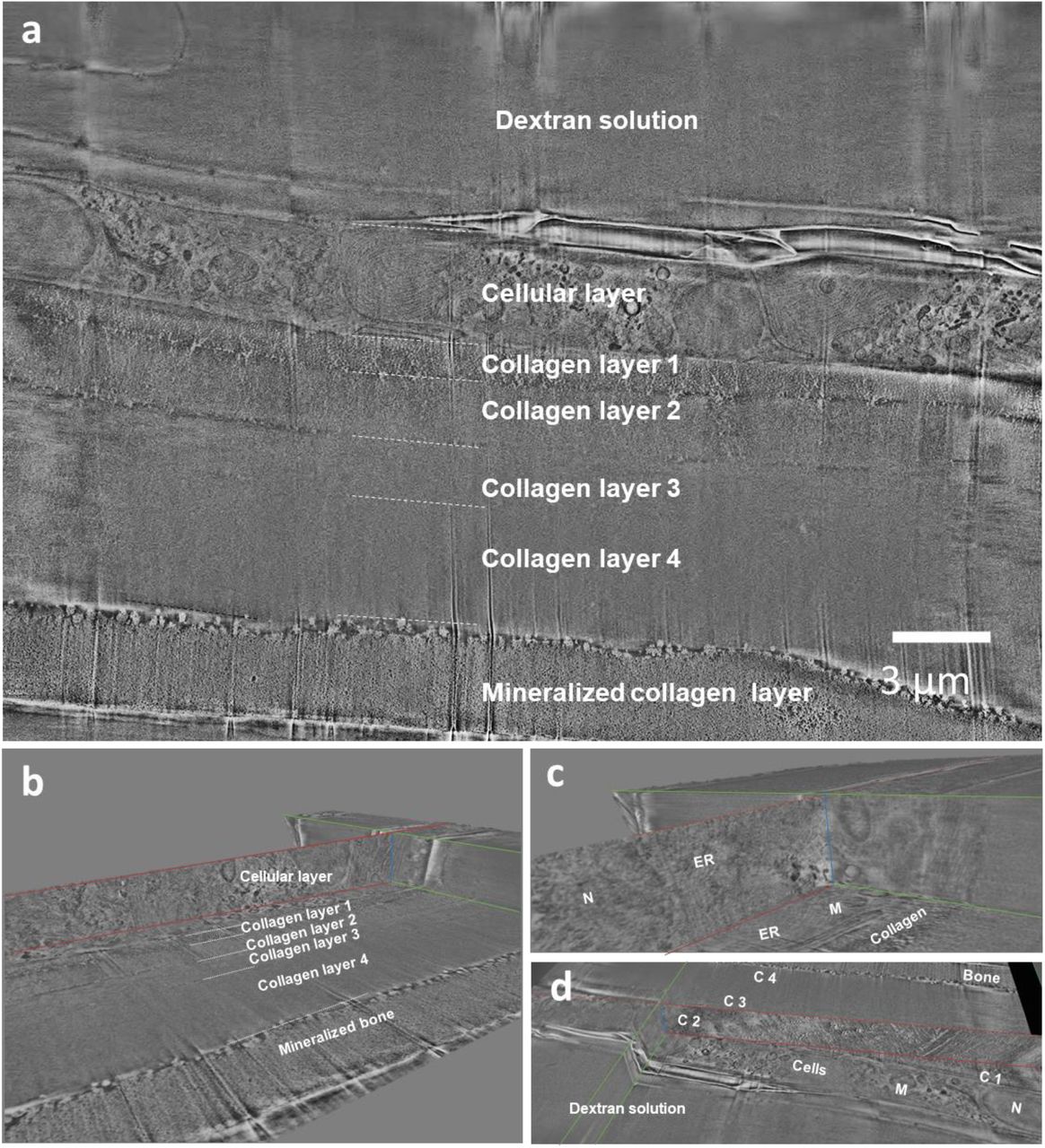 Cryogenic Focused Ion Beam Scanning Electron Microscopy | Thermo Fisher ...