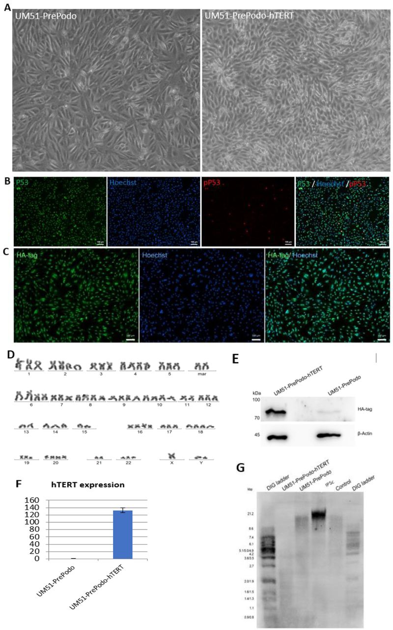 Plasmid Pcdna 3xha Htert | Addgene inc | Bioz