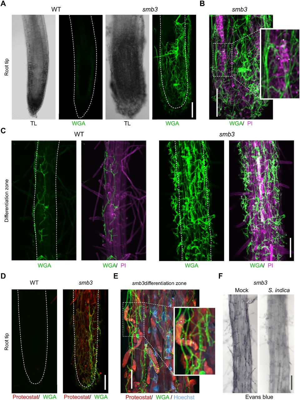Proteostat Aggresome Detection Kit | Enzo Life Sciences | Bioz