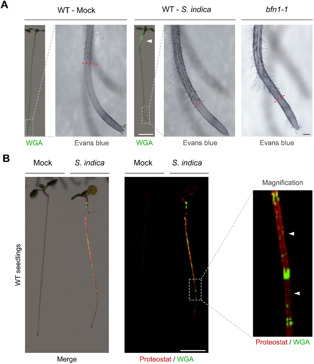 Proteostat Aggresome Detection Kit | Enzo Life Sciences | Bioz