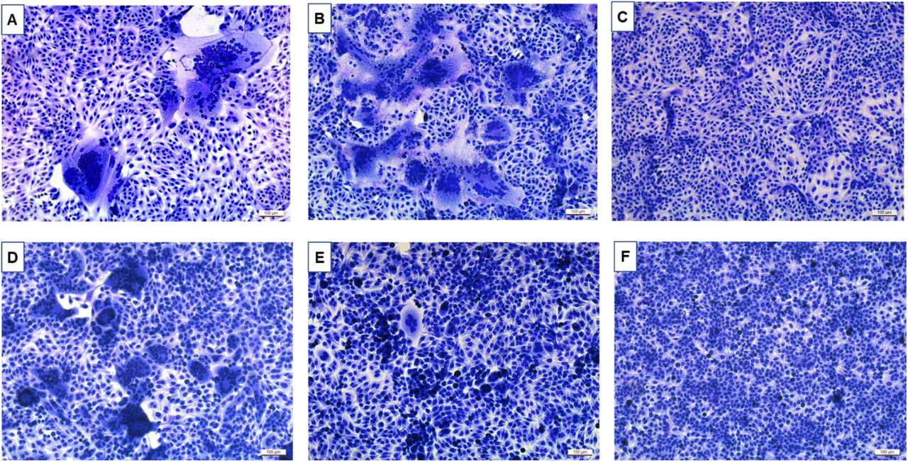 Hep2 Cells | ATCC | Bioz