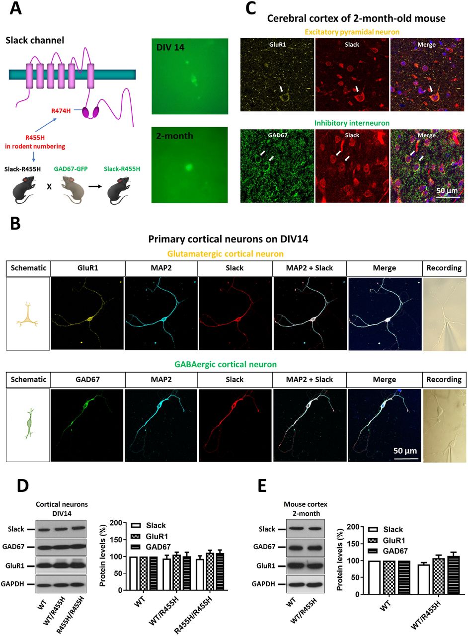 Gad67 Gfp Mice | The Jackson Laboratory | Bioz