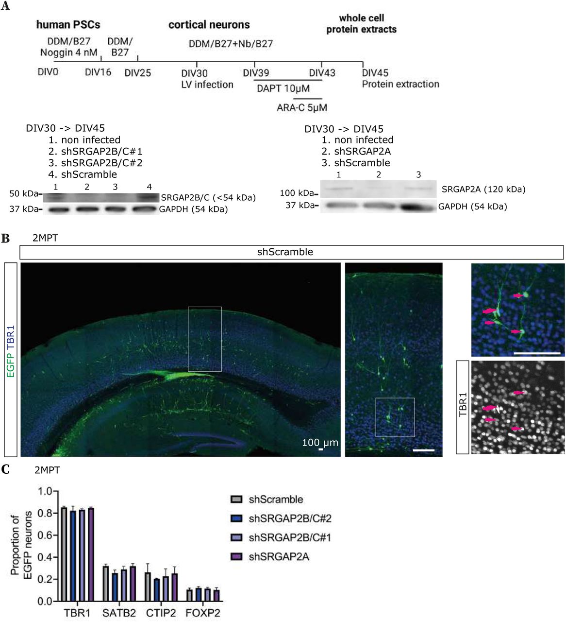 Rat Anti Ctip2 | Abcam | Bioz
