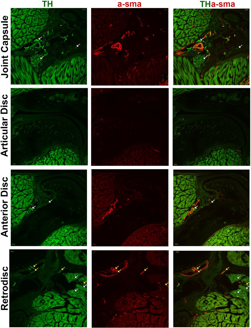 Monoclonal Mouse α Sma | Agilent technologies | Bioz
