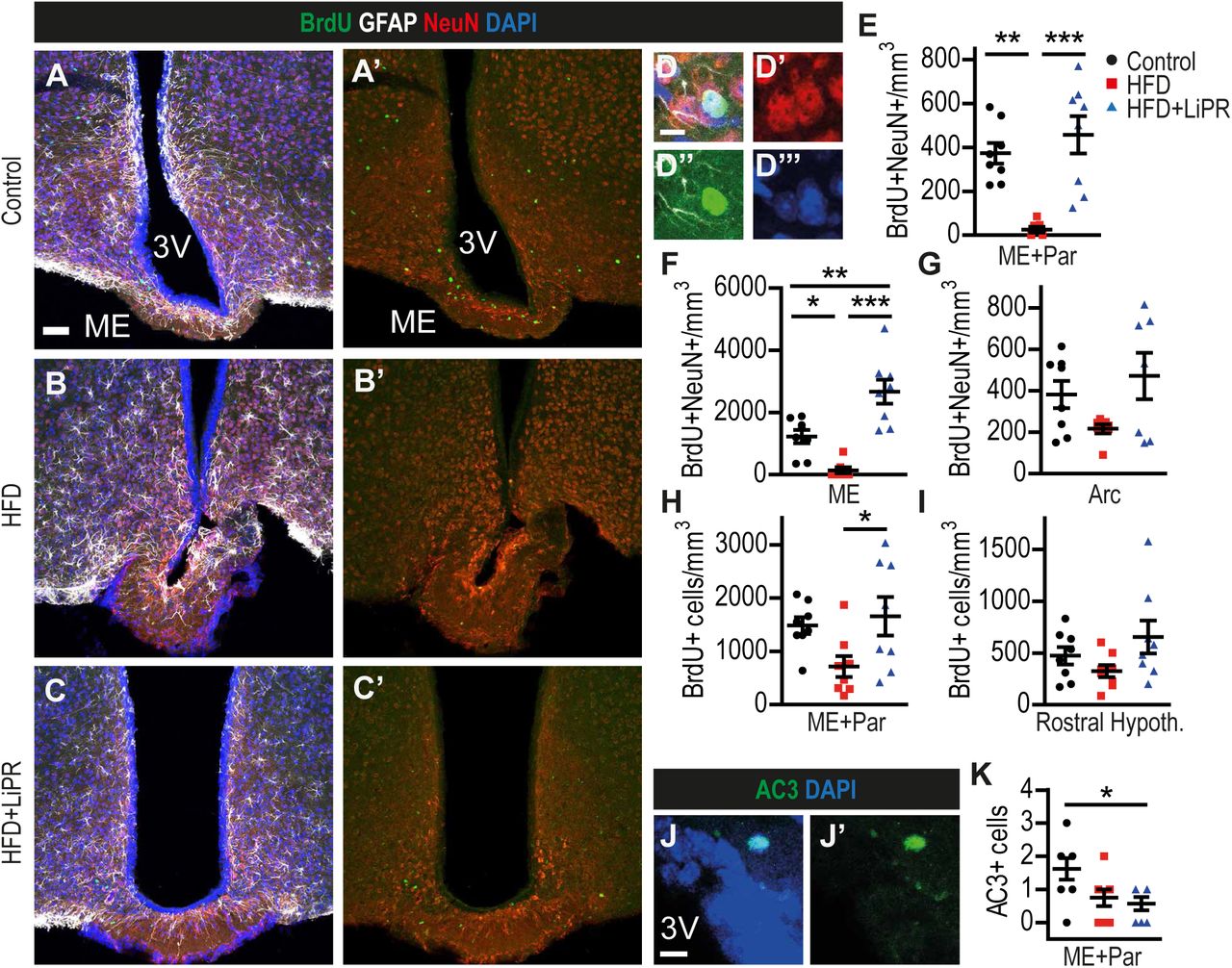 Rabbit Polyclonal Cleaved Caspase 3 Asp175 Antibody | Cell Signaling ...