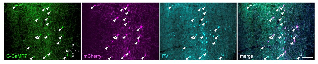 Pv Cre Stock No 017320 Mice | Jackson Laboratory | Bioz