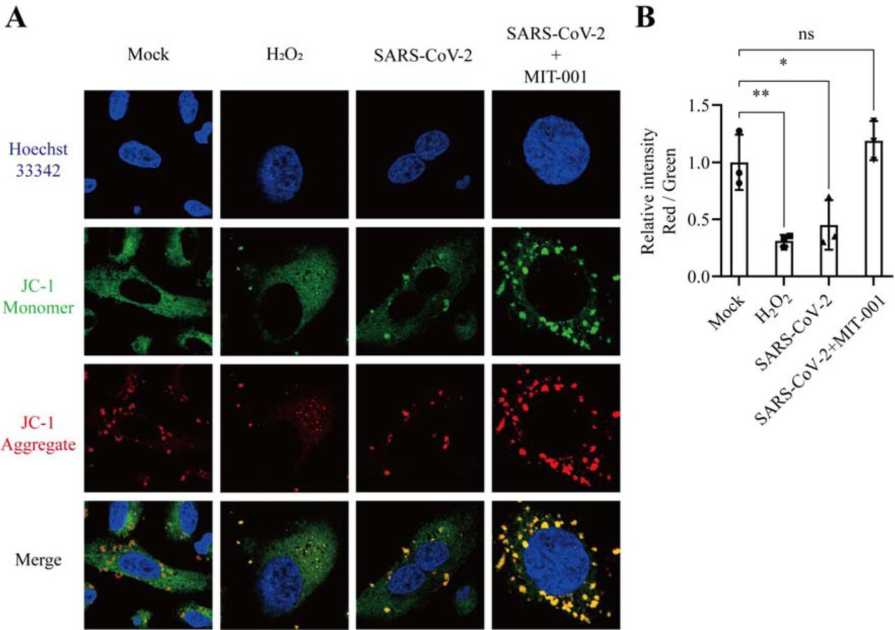 Jc 1 Stain | Thermo Fisher | Bioz
