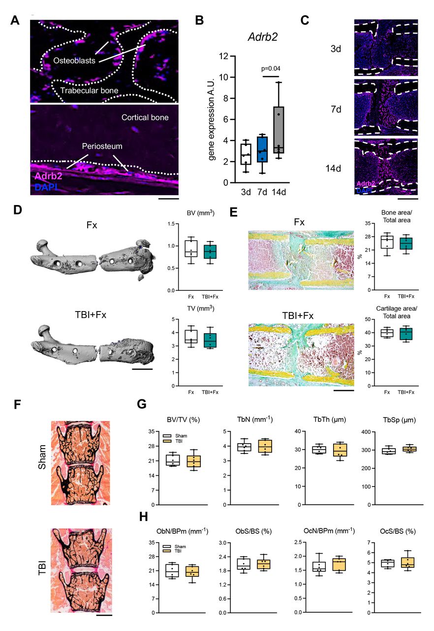 Osteomeasure System | OsteoMetrics inc | Bioz