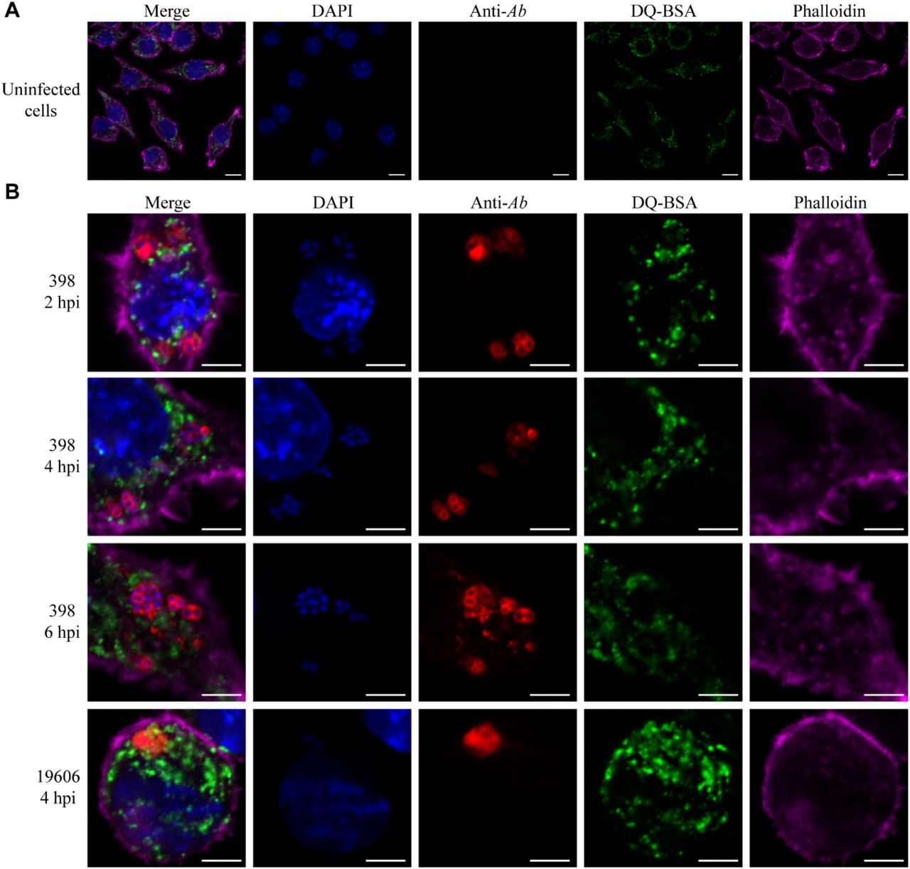 J774a 1 Mouse Macrophage Cell Line | ATCC | Bioz