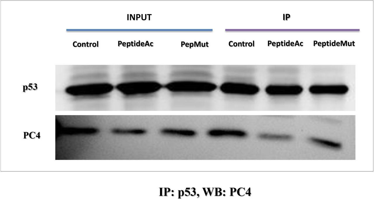Human Lung Cancer Cell Lines H1299 | ATCC | Bioz
