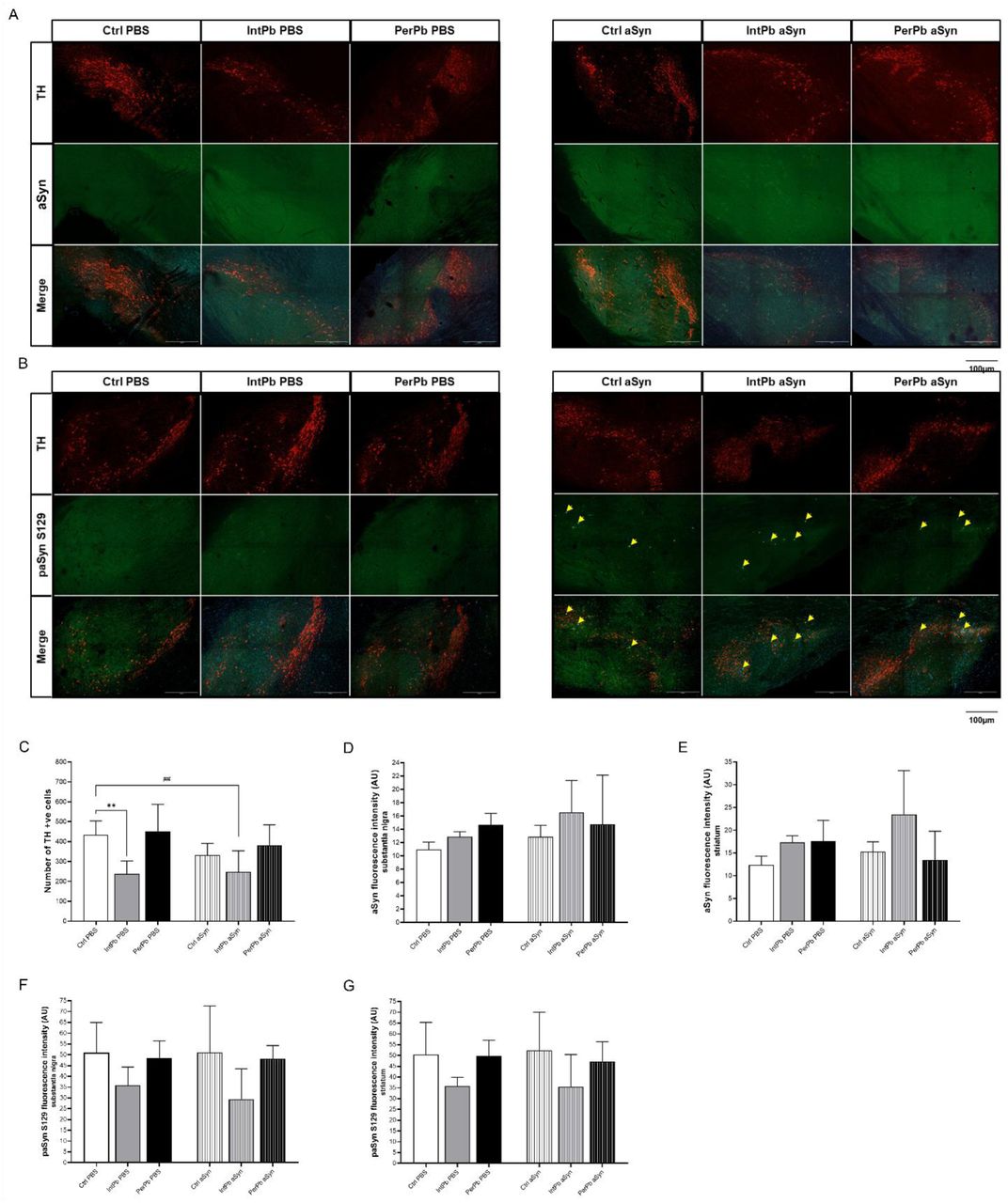 Introduction Amyloid β Aβ Plaques Deposition | Bioz