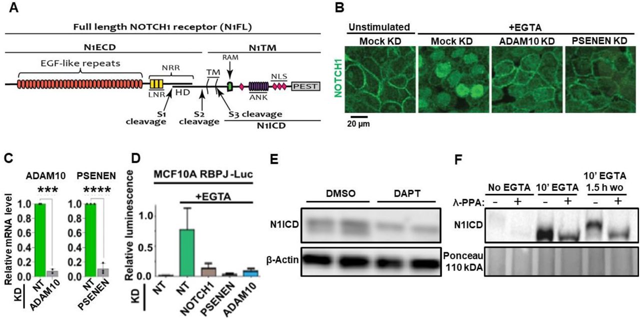 Anti Notch1 | Cell Signaling Technology Inc | Bioz