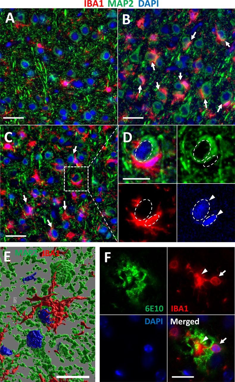 Rabbit Polyclonal Anti Iba1 | FUJIFILM | Bioz