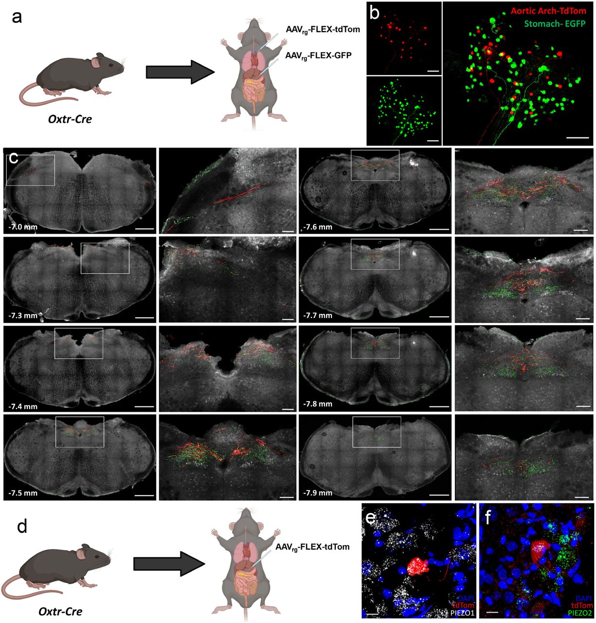 Rnascope Multiplex Fluorescent Reagent Kit V2 | Advanced Cell ...