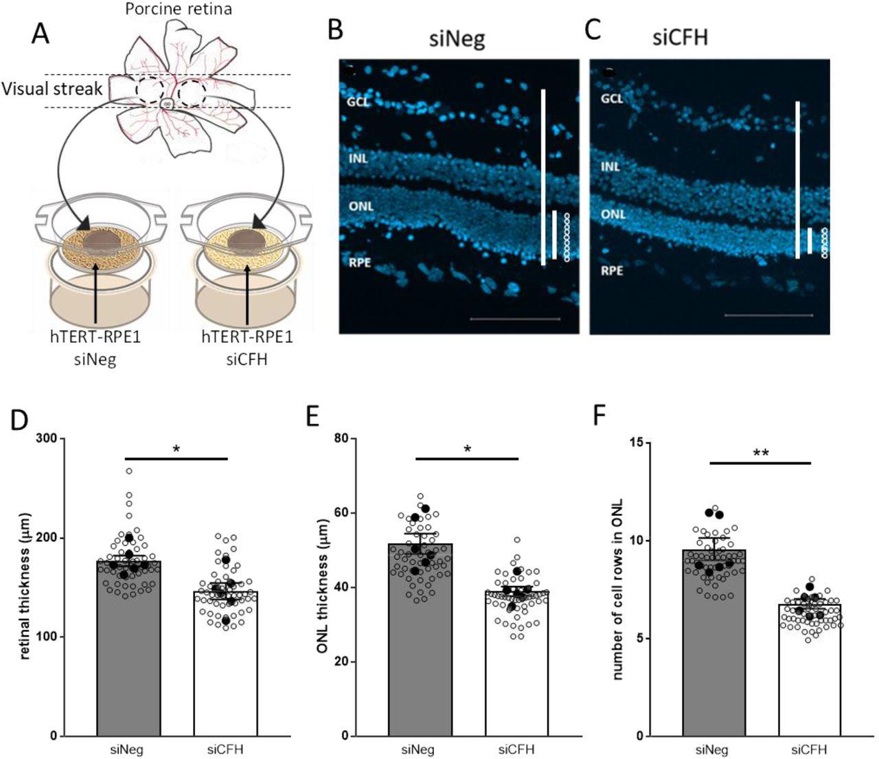 Retinal Pigment Epithelium Rpe Cell Line Htert Rpe1 | ATCC | Bioz