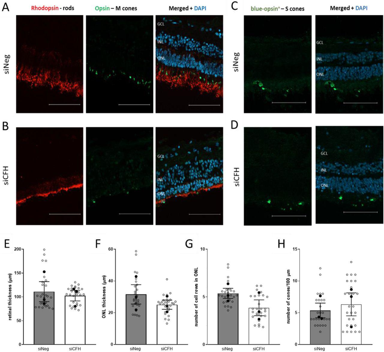 Retinal Pigment Epithelium Rpe Cell Line Htert Rpe1 | ATCC | Bioz