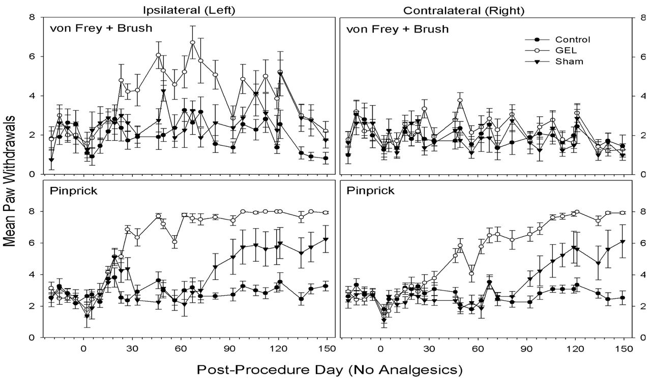 Static Mechanical Allodynia Von Frey Filaments | North Coast Medical | Bioz