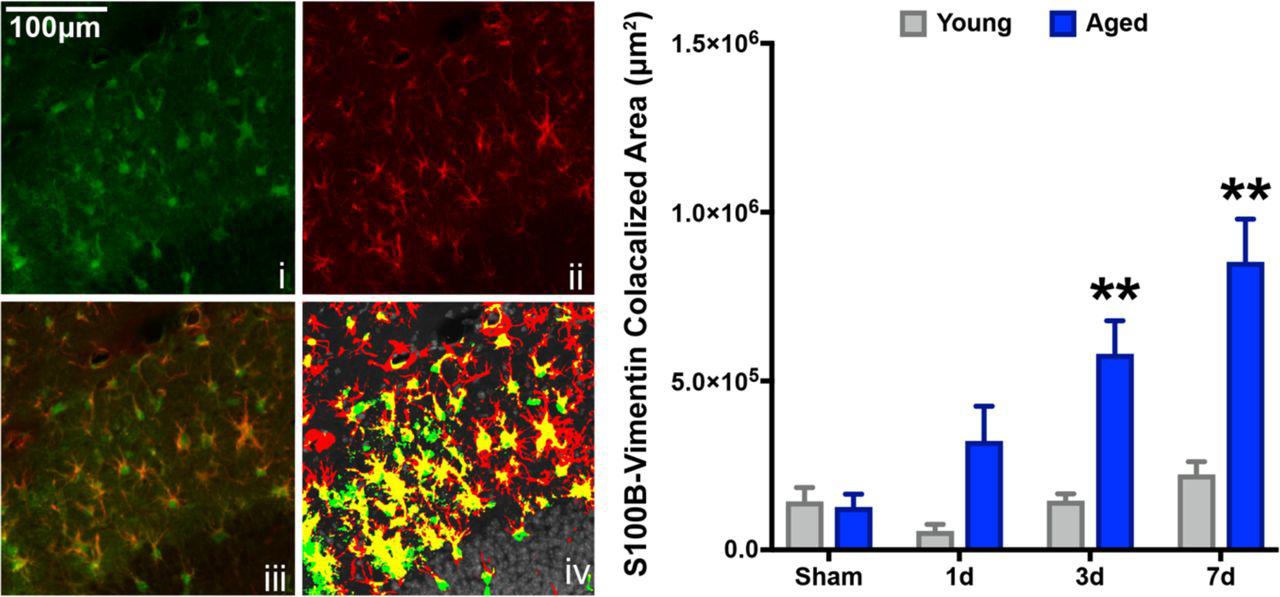 S100b | Agilent technologies | Bioz