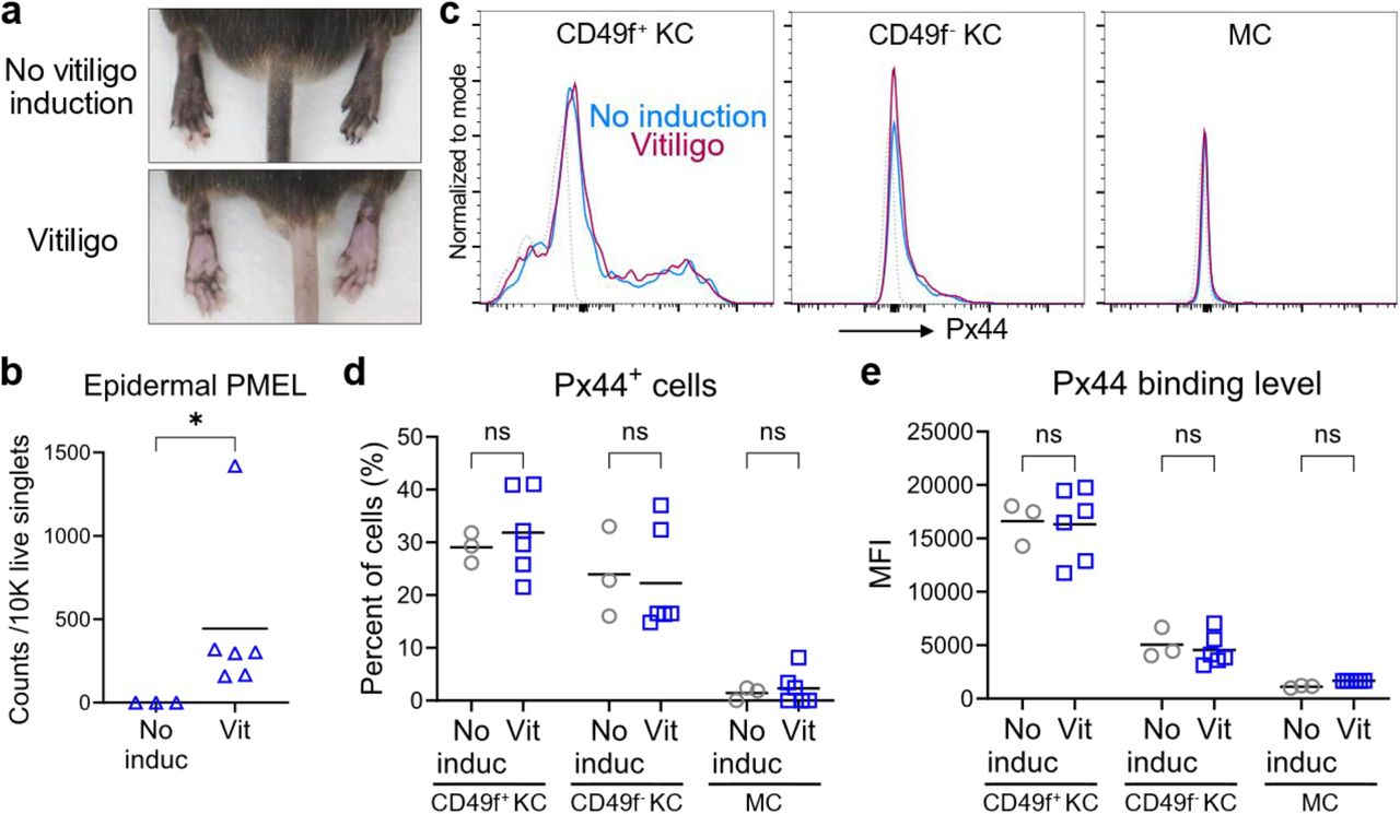 Thy1 1 Pmel Tcr Transgenic Mice | The Jackson Laboratory | Bioz
