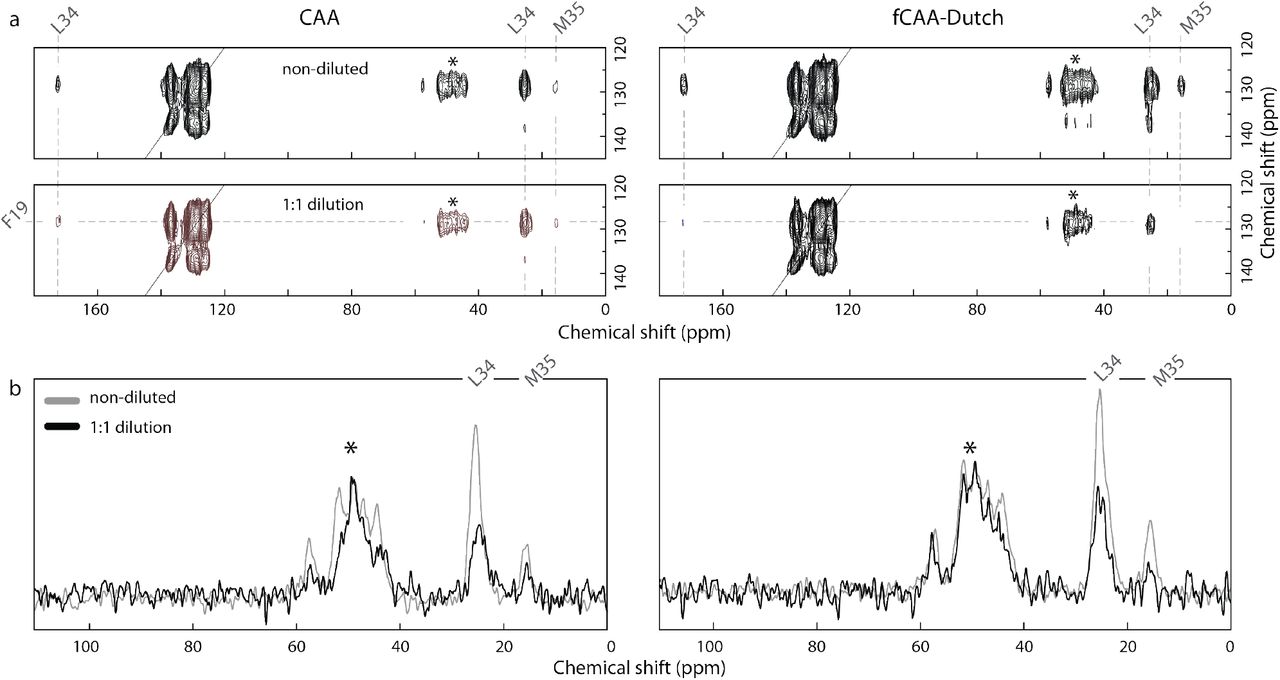 Solid State Nuclear Magnetic Resonance Nmr Spectroscopy | Thermo Fisher ...