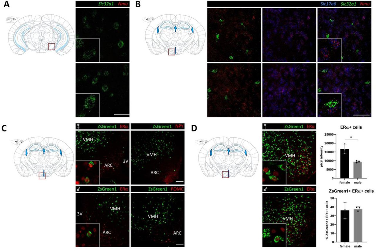 Slc17a6 | Advanced Cell Diagnostics Inc | Bioz