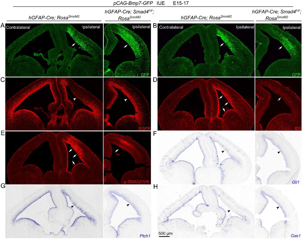 Smad4 Flox Flox Mice | The Jackson Laboratory | Bioz