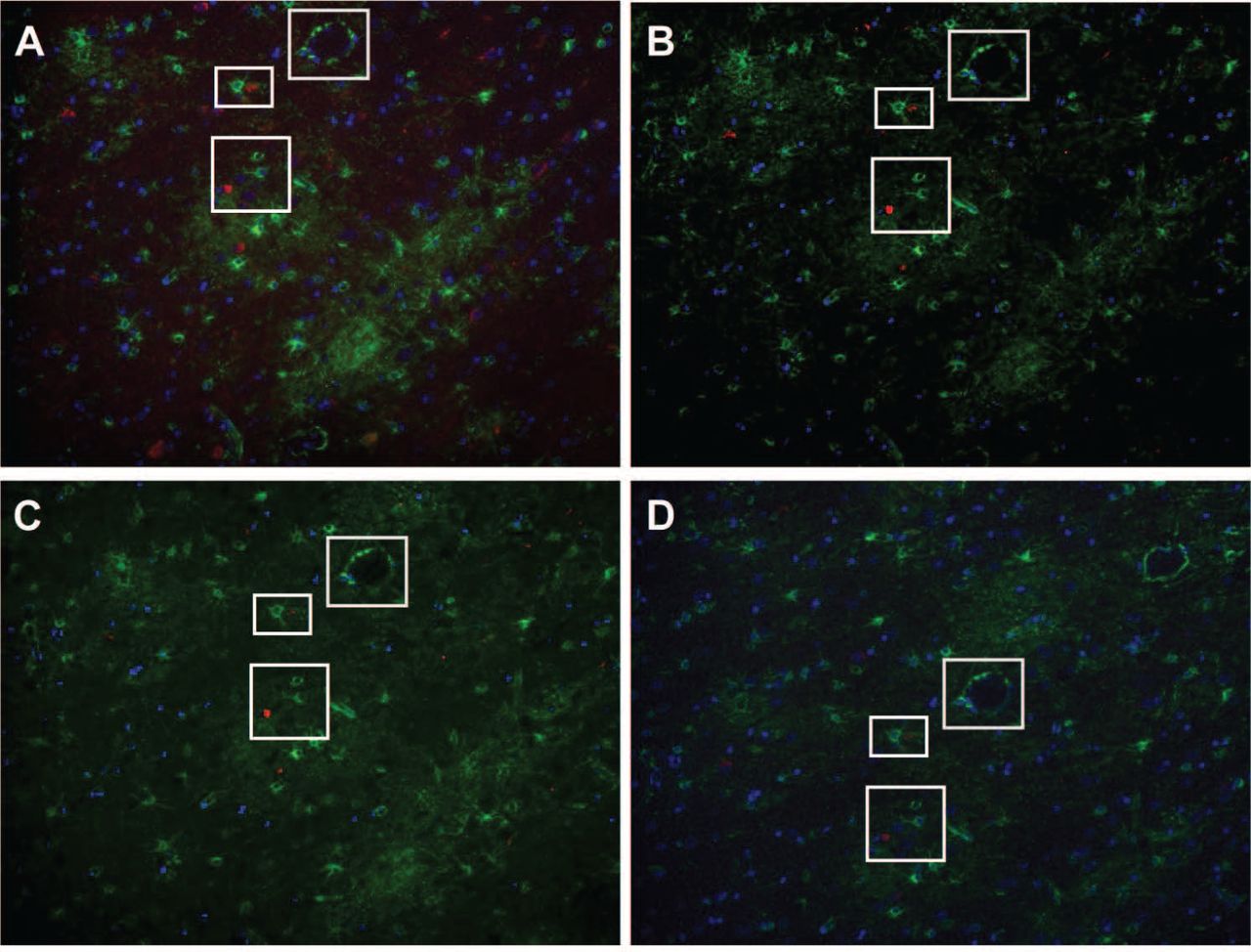Gfap Rabbit Z0334 | Dako | Bioz