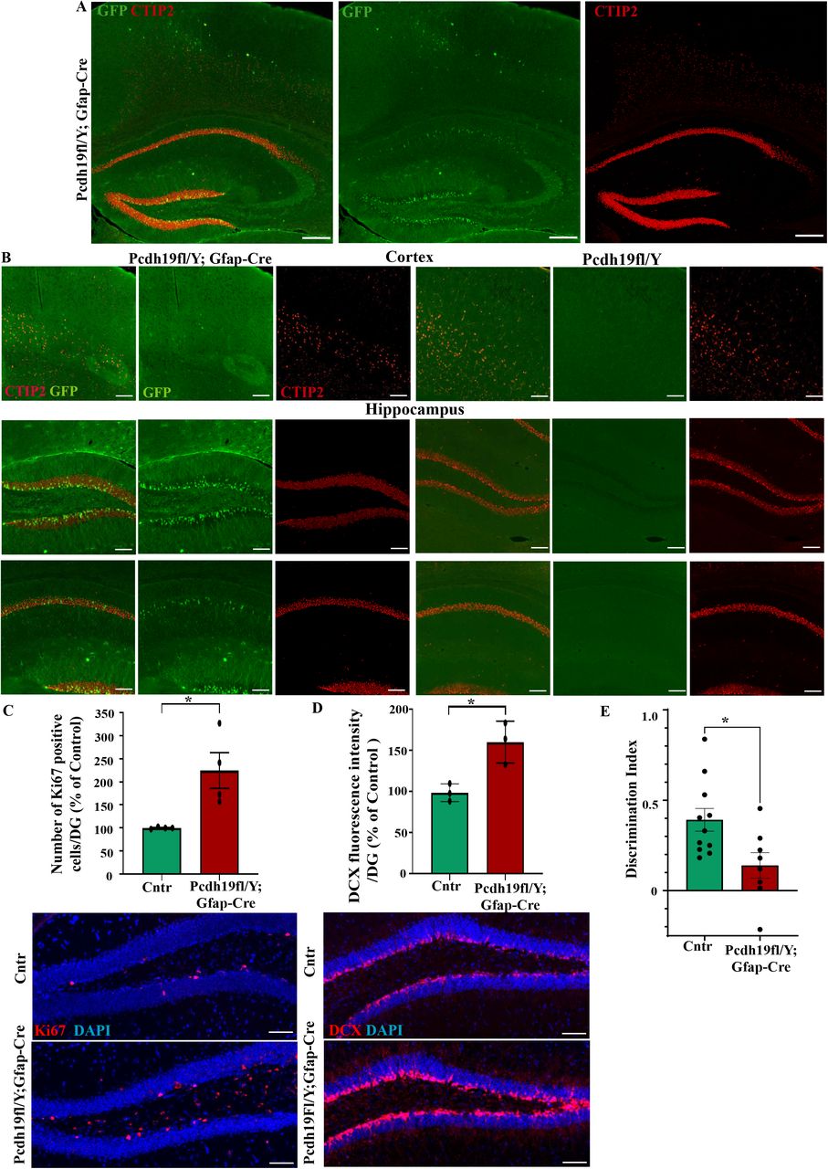 Gfap Cre | The Jackson Laboratory | Bioz